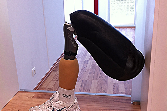 Potek obravnave oz.izdelave nove proteze | MOOR